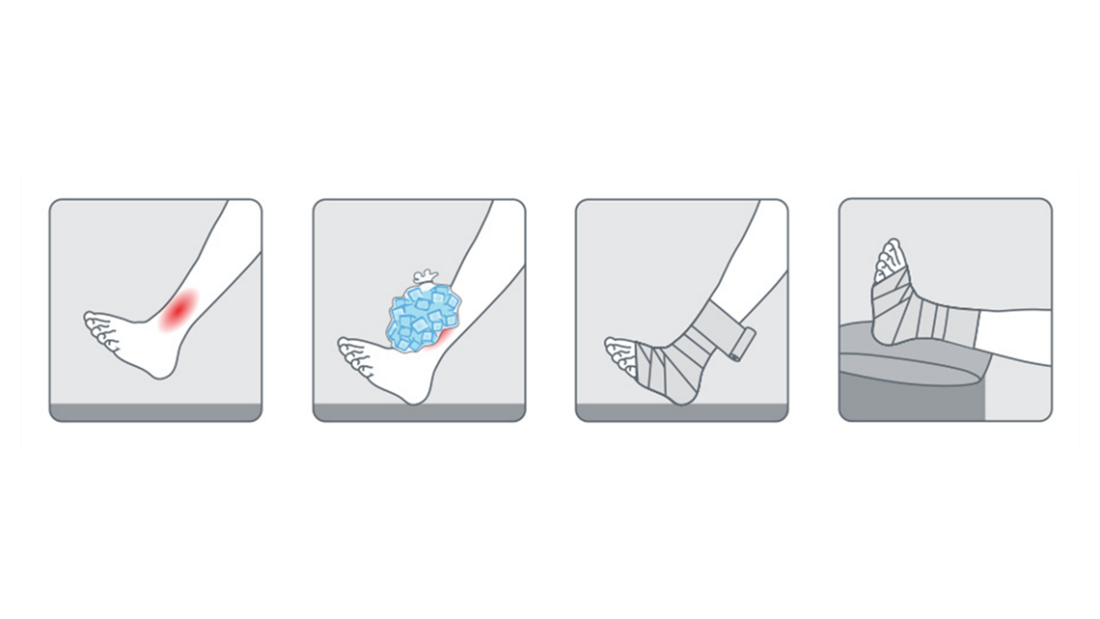 Cum sa tratezi o entorsa a gleznei | Nurofen Romania | Nurofen